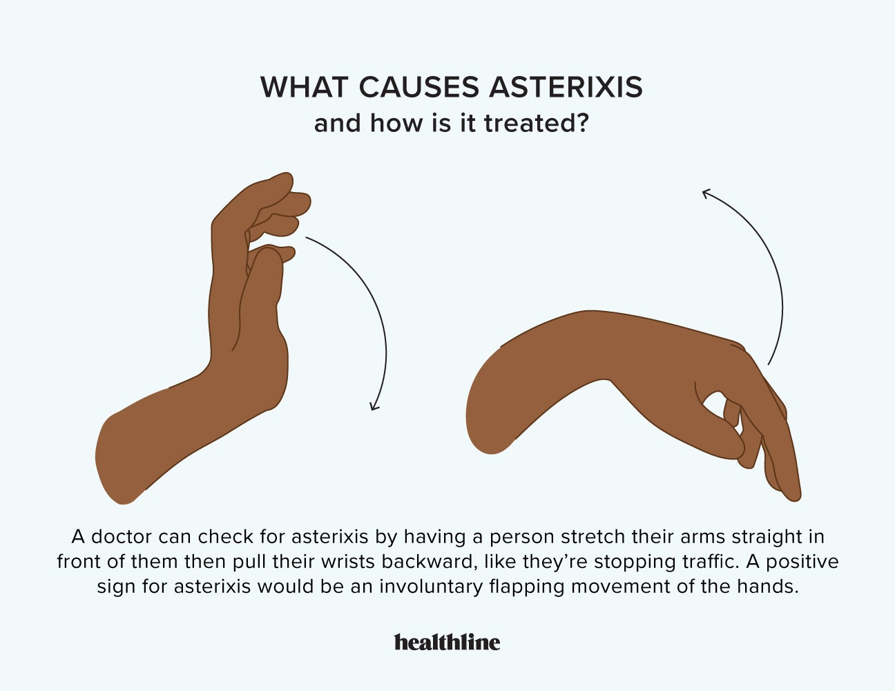 Asterixis: What Is It, Causes, Liver, and More